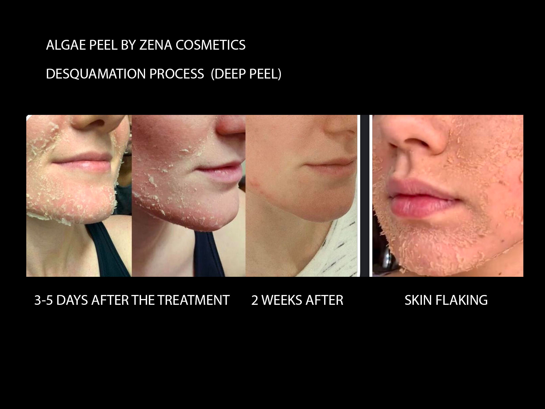 AESTHETIC TREATMENTS - Puerto Banus Nail Bar & Aesthetics Cork